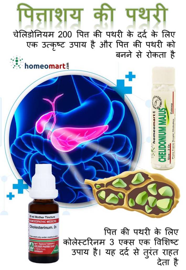 पित्त की पथरी के लिए होम्योपैथी, Pitt ki thaili me pathri ka ilaj ...