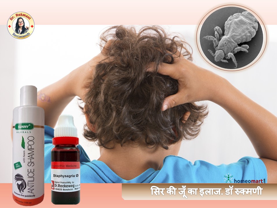 जमजुई का होम्योपैथी इलाज Head Lice Treatment – Homeopathy Hindi